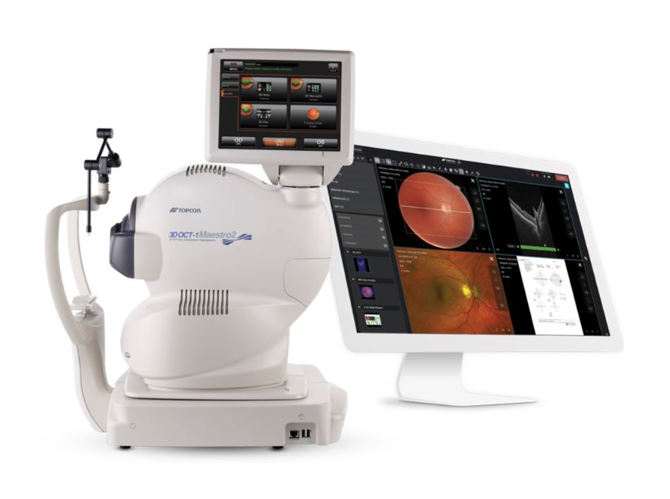 OCT SCANs | Barrhaven Eye Care